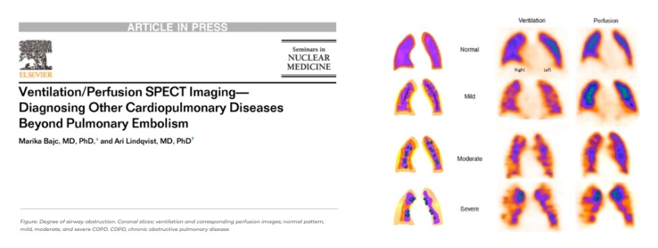 Pulmonary care - Cyclomedica