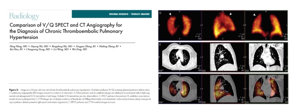 Pulmonary care - Cyclomedica